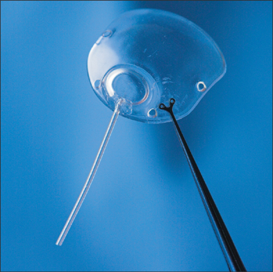 Ophthalmology Management | PentaVision