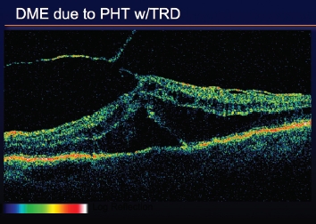 Ophthalmology Management | PentaVision