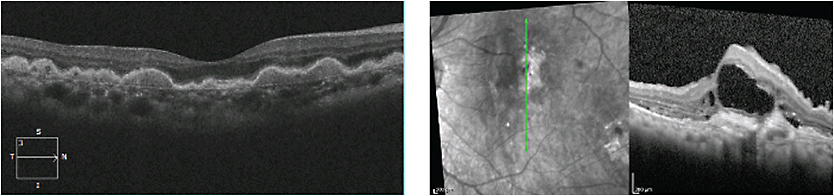 Ophthalmology Management | PentaVision