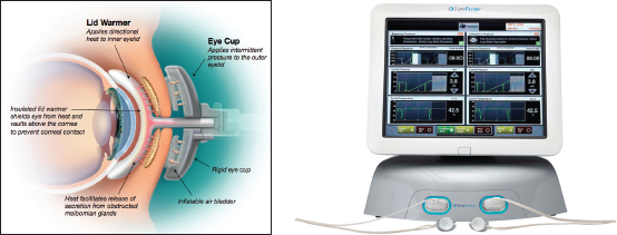 Ophthalmology Management | PentaVision