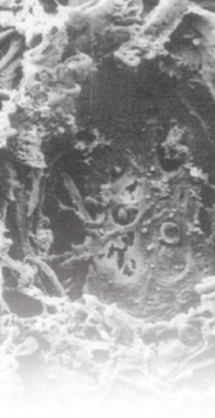 Ophthalmology Management | PentaVision