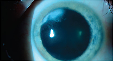 Ophthalmology Management | PentaVision