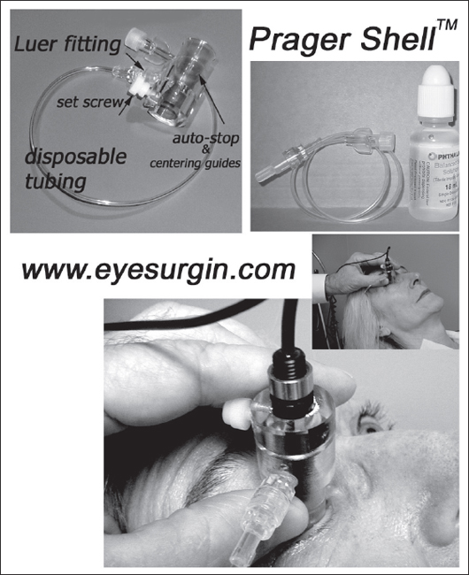 Ophthalmology Management | PentaVision