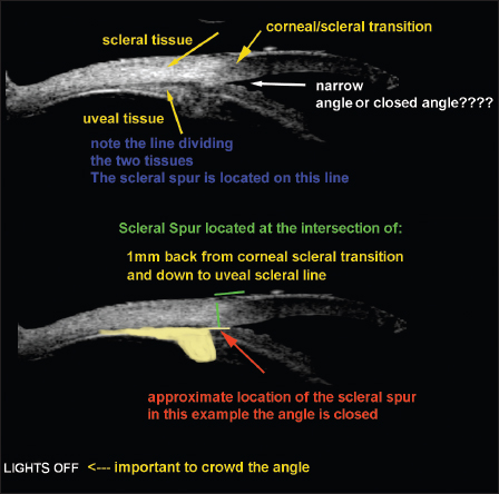 Ophthalmology Management | PentaVision