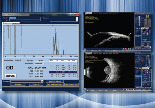 Ophthalmology Management | PentaVision