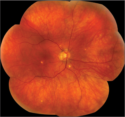 Ophthalmology Management | PentaVision