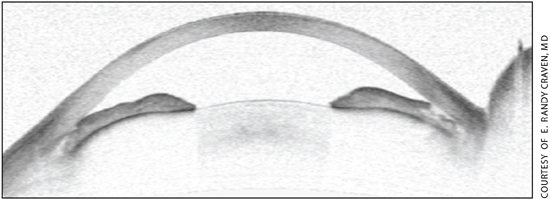 Ophthalmology Management | PentaVision