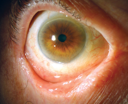 Ophthalmology Management | PentaVision