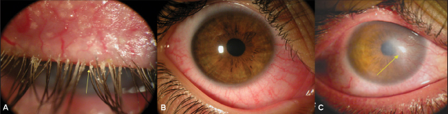 Ophthalmology Management | PentaVision