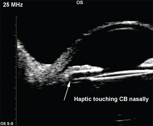 Ophthalmology Management | PentaVision