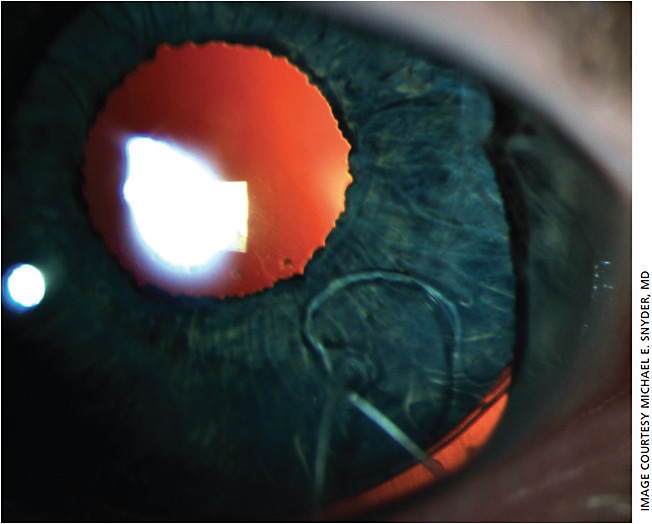 Ophthalmology Management | PentaVision