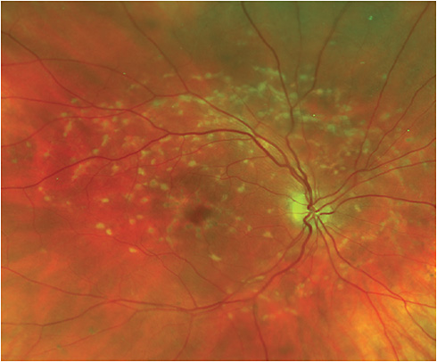 Ophthalmology Management | PentaVision