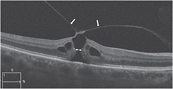 Ophthalmology Management | PentaVision