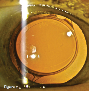 Ophthalmology Management | PentaVision