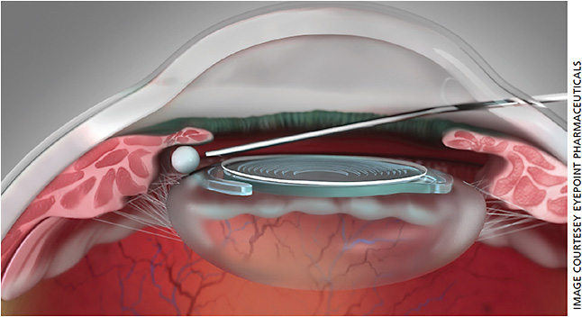 Ophthalmology Management | PentaVision