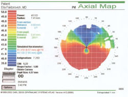Ophthalmology Management | PentaVision