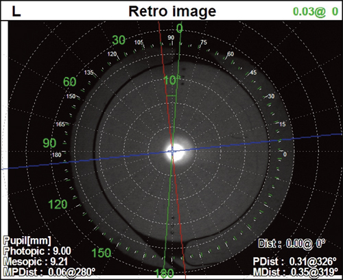 Ophthalmology Management | PentaVision