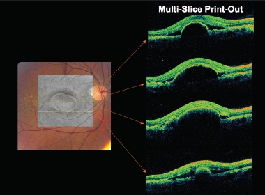 Ophthalmology Management | PentaVision