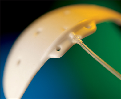 Ophthalmology Management | PentaVision