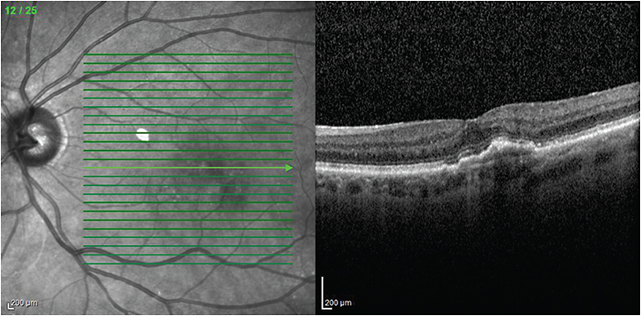 Ophthalmology Management | PentaVision