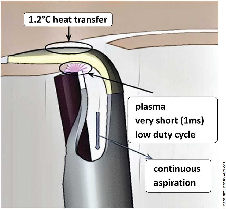 Ophthalmology Management | PentaVision