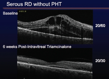 Ophthalmology Management | PentaVision