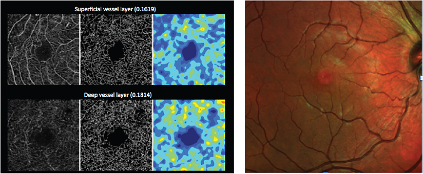Ophthalmology Management | PentaVision