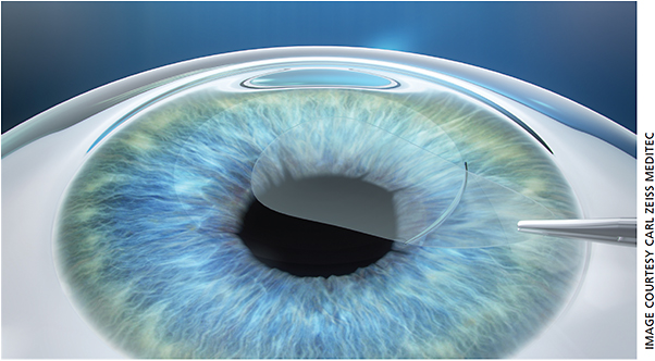 Ophthalmology Management | PentaVision