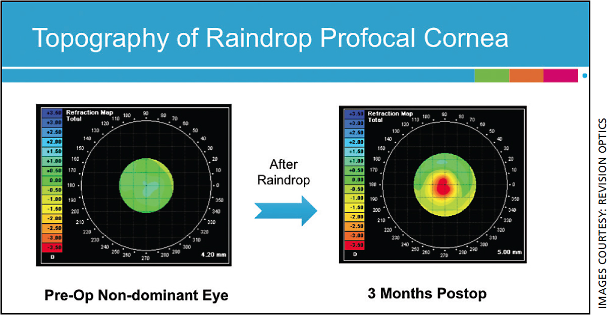 Ophthalmology Management | PentaVision