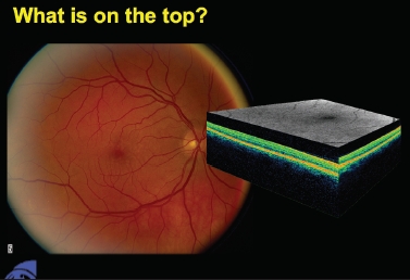 Ophthalmology Management | PentaVision