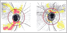 Ophthalmology Management | PentaVision