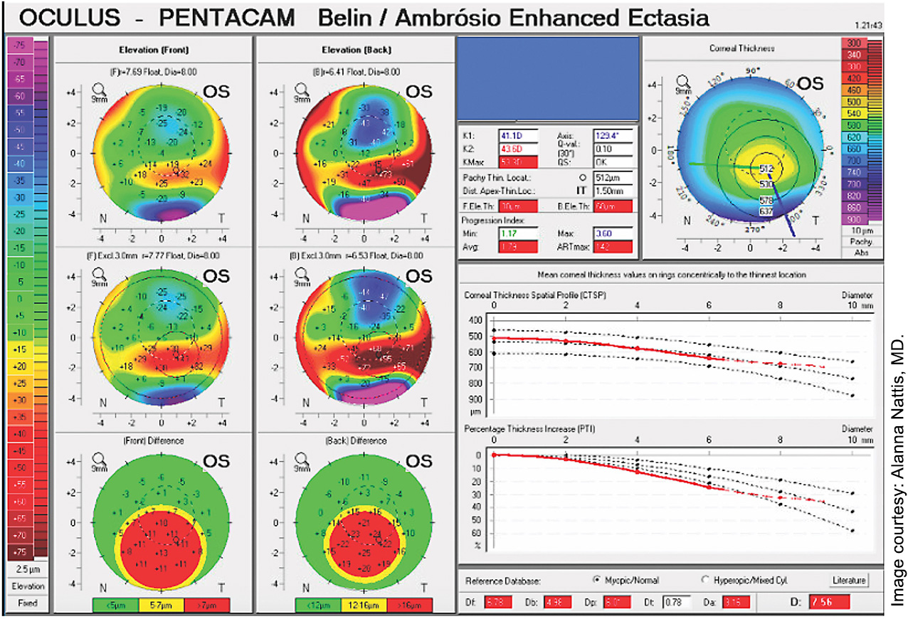 Ophthalmology Management | PentaVision